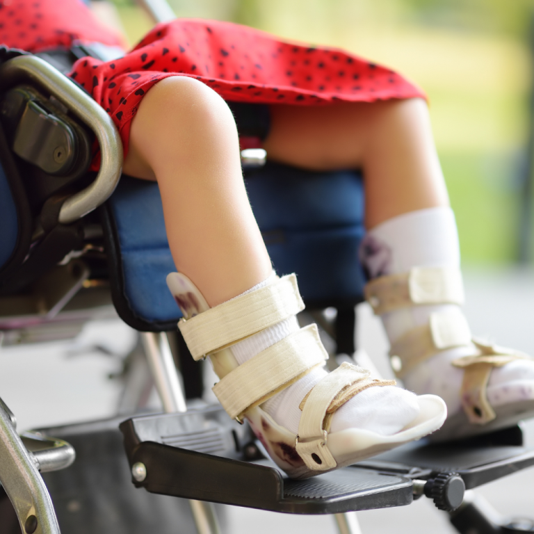 What Is Selective Dorsal Rhizotomy (SDR) and How Can It Help?